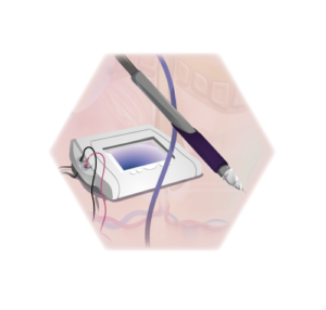 needle epilation | state of the art technology & best service